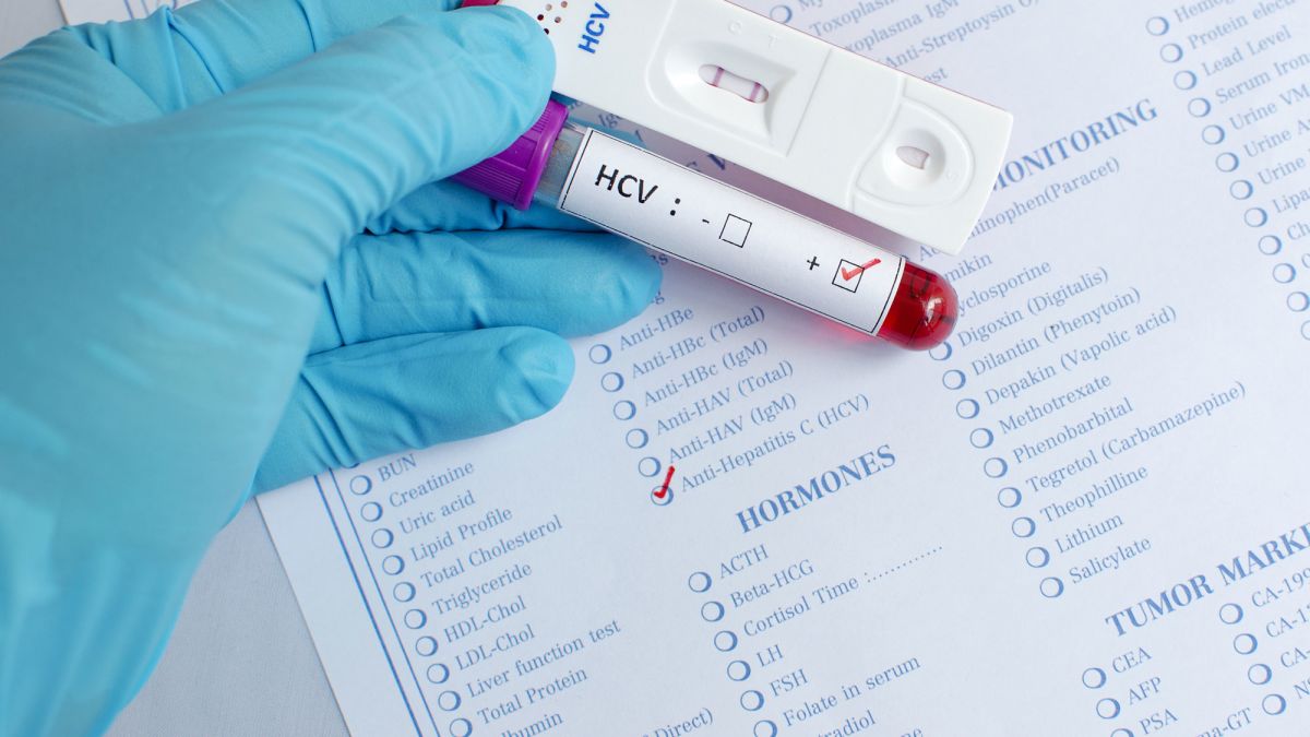 Hepatitis Profile - Isiah Hospital and Medical Center
